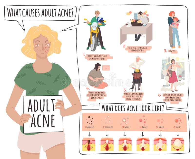 Causes Of Acne Skin Problems And Diseases Beauty Infographics Stock