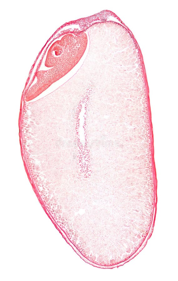 Wheat Grain, Cross Section of a Whole Wheat Berry, 8X Light Micrograph ...