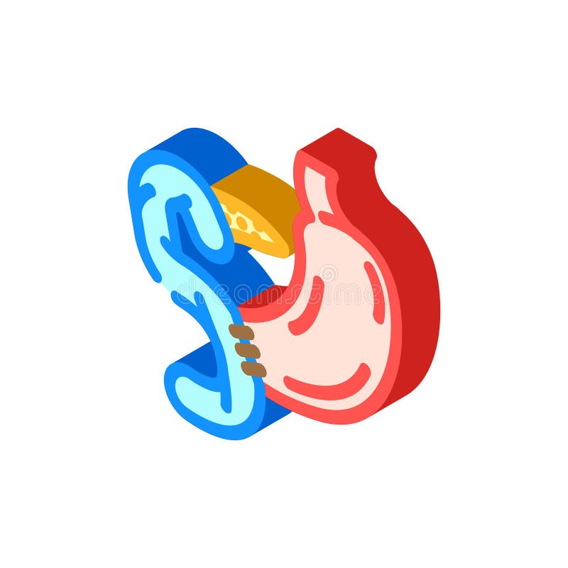 Whipple Procedure Surgery Isometric Icon Vector Illustration Stock ...