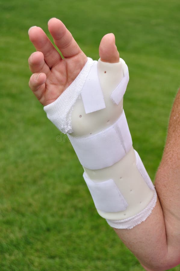 White Arm Brace stock photo. Image of healthcare, wrist - 24145962