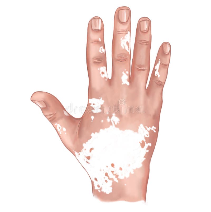 White Backround Digital Illustration Human Skin and Hair Structure ...