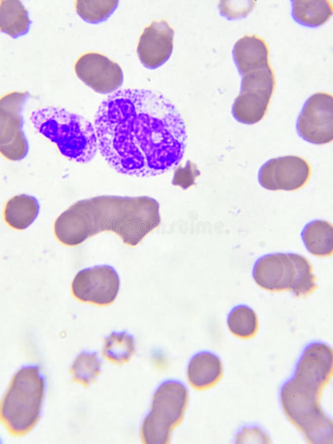 White blood cell stock photo. Image of laboratory, hematopoiesis - 97101636