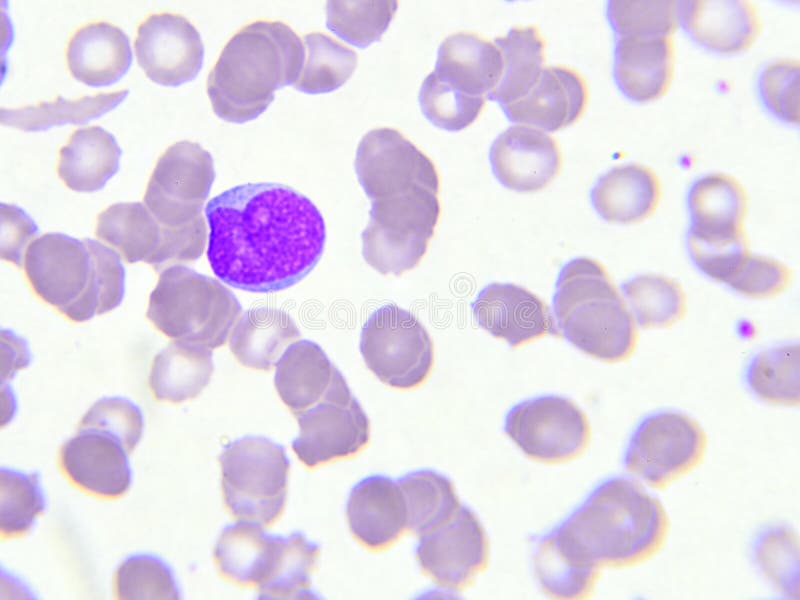 White blood cell stock photo. Image of microscope, cell - 97101670