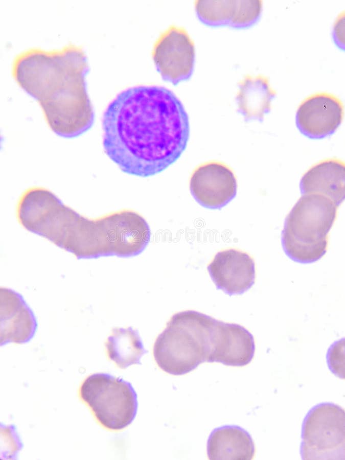 White blood cell stock photo. Image of anemia, blood - 97101934
