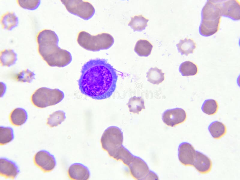 White blood cell stock image. Image of blood, hematology - 97101999