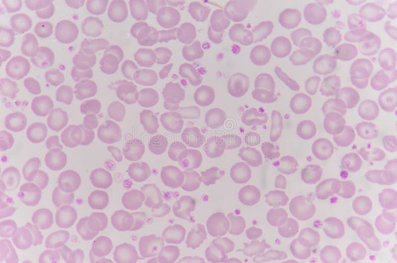 White Blood Cells Background. Stock Image - Image of blast, band: 78448279