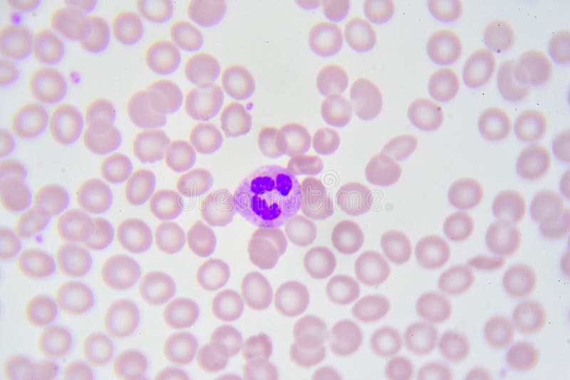 White blood cells stock image. Image of hematopoiesis - 92253557