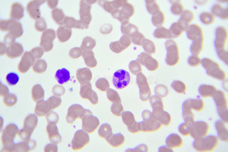 White blood cells stock image. Image of anemia, disease - 92253743