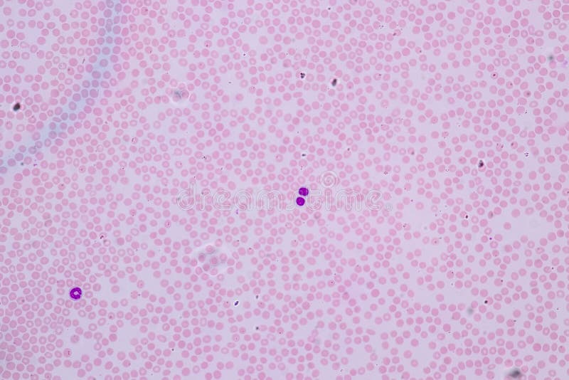 White Blood Cells are the Cells of the Immune System Under the ...