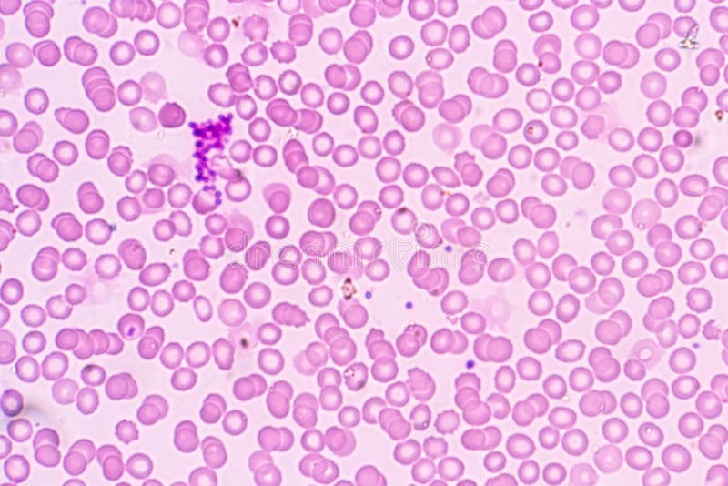 White Blood Cells are the Cells of the Immune System Under the ...