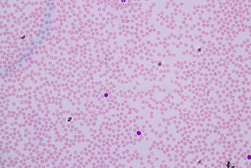 Frog Blood Cell Under Microscope