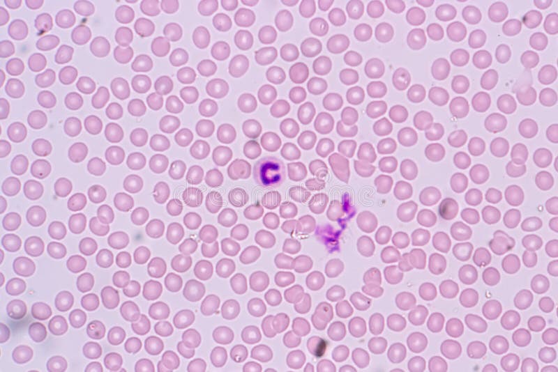 White Blood Cells are the Cells of the Immune System Under the ...