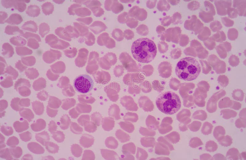 White Blood Cells of a Human, Photomicrograph Panorama As Seen U Stock ...