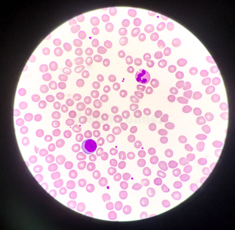 White Blood Cells of a Human, Photomicrograph Panorama As Seen U Stock ...