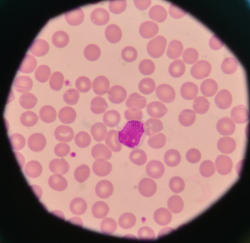 White Blood Cells on Red Blood Cells Background. Stock Image - Image of ...