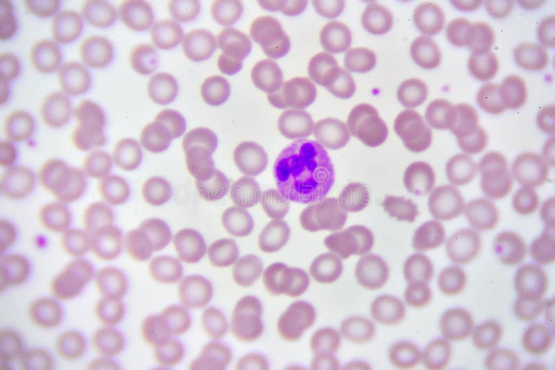 White Blood Cells stock image. Image of laboratory, graphic - 23262759