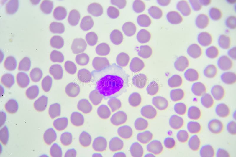 White blood cells stock image. Image of analyzing, microscopic - 92594137