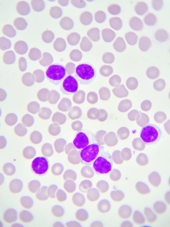 What Is The Color And Shape Of White Blood Cells Socratic