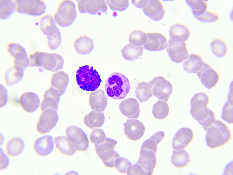 Lymphocyte cells stock photo. Image of health, neutrophil - 92594216