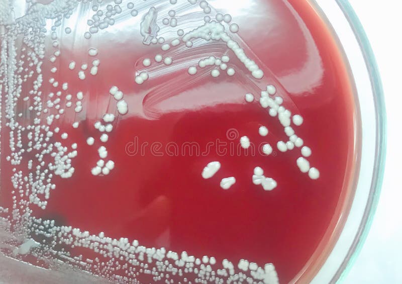 White colony on blood agar stock photo. Image of experiment - 189757722