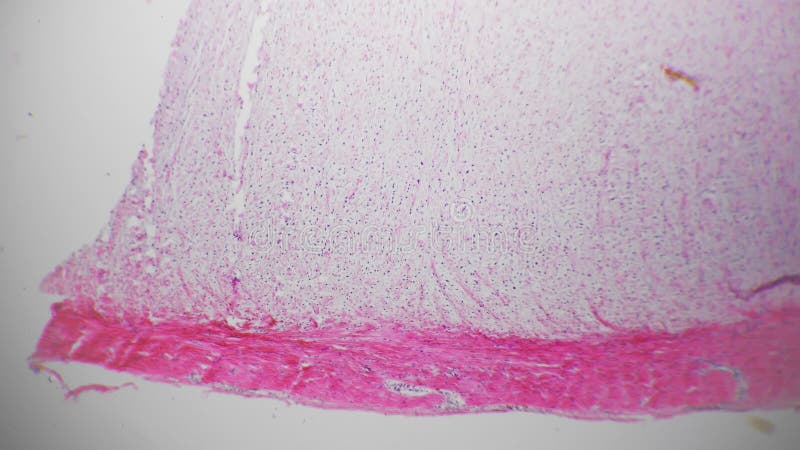 Dense Connective Tissue of Human Whole Mount Filmed Under Microscope ...