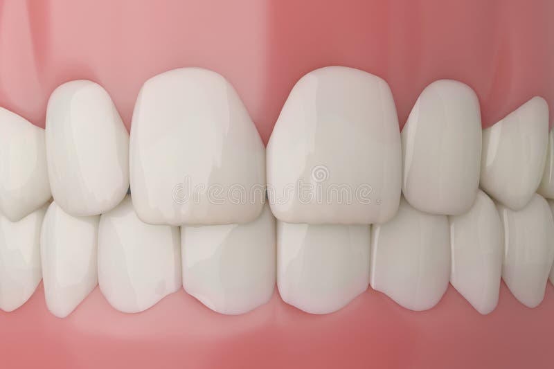 White Front Teeth and Healthy Gums Stock Illustration - Illustration of ...