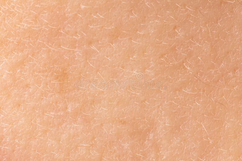 Mole On The Human Skin. Macro Stock Image - Image of spot, dermatology ...