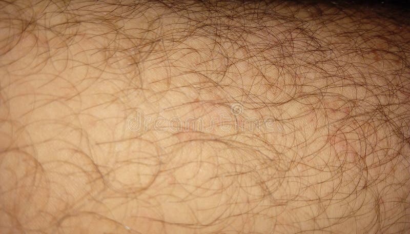 White Human Skin with Thin Black Hairs. Stock Photo - Image of floor ...