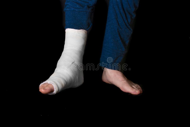 White leg cast stock photo. Image of health, patient - 72090462