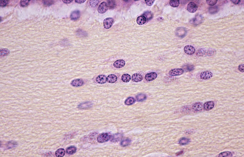 White Matter. Oligodendroglia Stock Image - Image of tissue, microscope ...