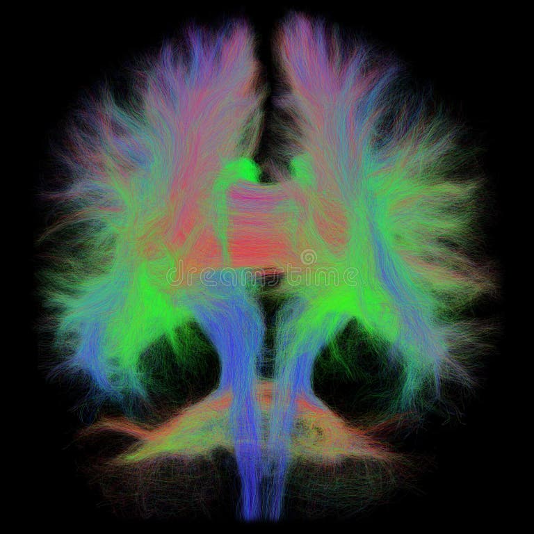 Diffusion Mri Stock Photos - Free & Royalty-Free Stock Photos from ... Diffusion Mri Stock Photos - Free & Royalty-Free Stock Photos from ...