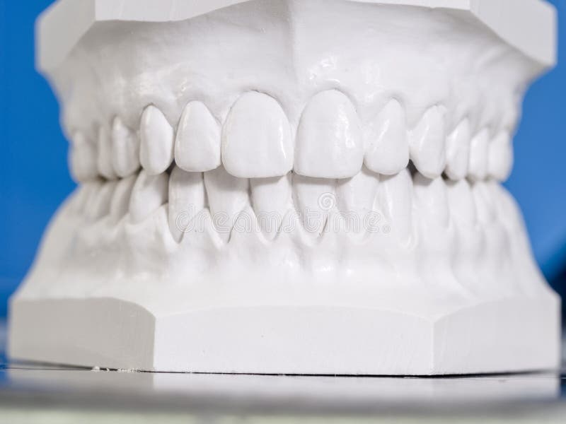White Mold Dental of Plaster Stock Photo - Image of medicine, model ...