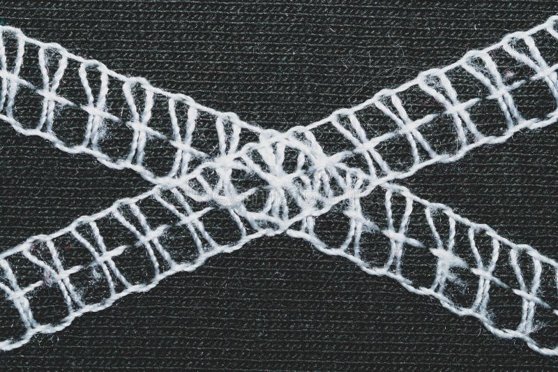 3 Black Stitches Over Caucasian Skin, Macro View Stock Image - Image of ...