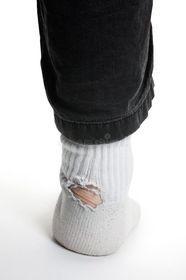 Broken Sock with a Hole in a Man`s Big Toe, Concept of Poverty during ...