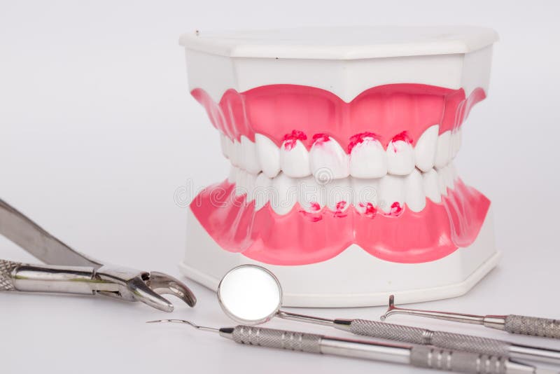 White Teeth and Dental Instruments Stock Photo - Image of oral ...