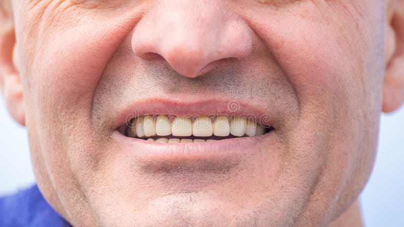 208 Smile Toothed White Stock Photos - Free & Royalty-Free Stock Photos ...