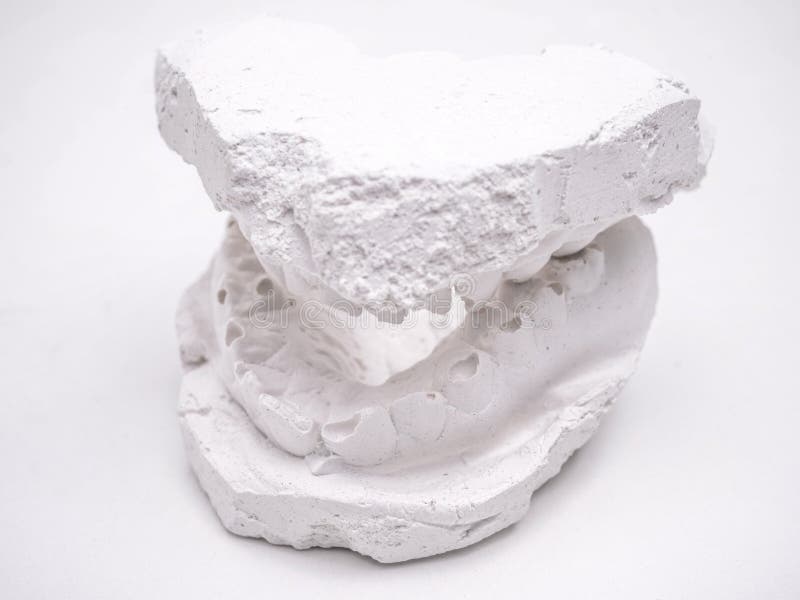 Whole Jaw Gypsum Impression Stock Image - Image of side, dentist: 128244761