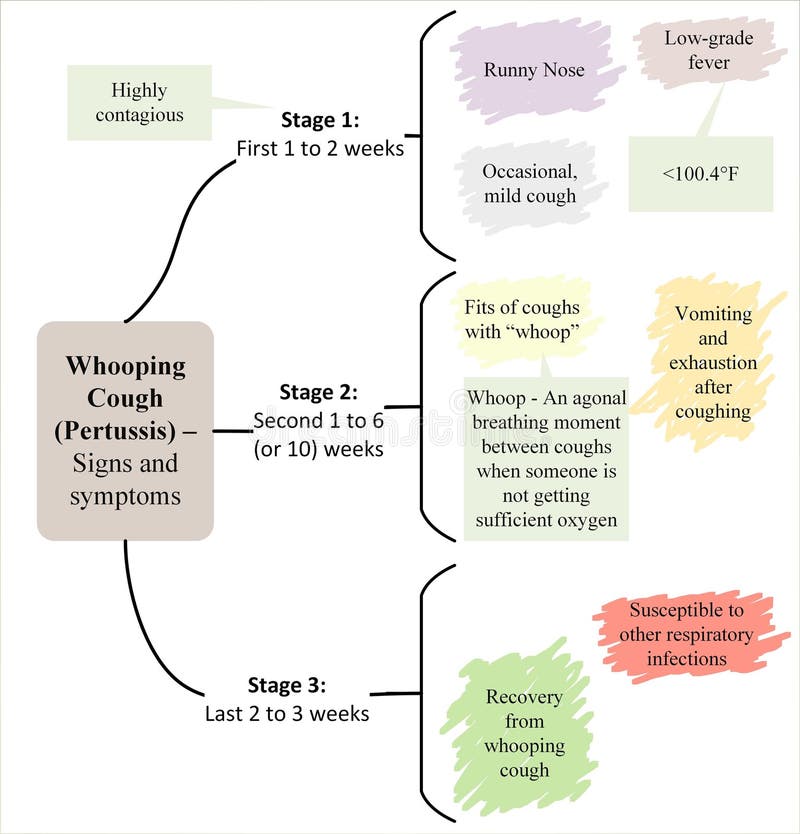 Whooping Cough (pertussis) - Signs and Symptoms Stock Illustration ...