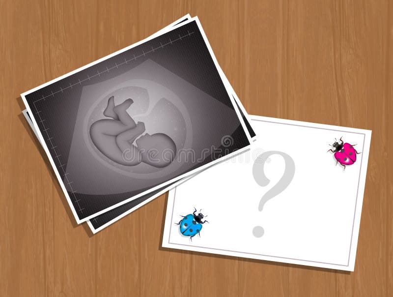 Will the Male or the Female Be Born Stock Illustration - Illustration ...