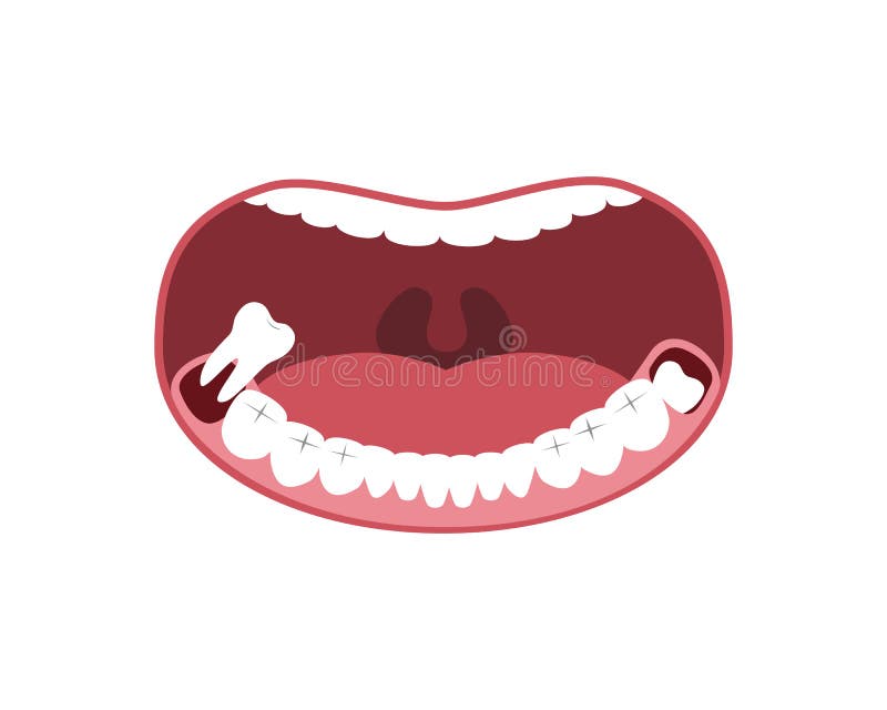 Wisdom teeth. stock illustration. Illustration of problem - 196329388