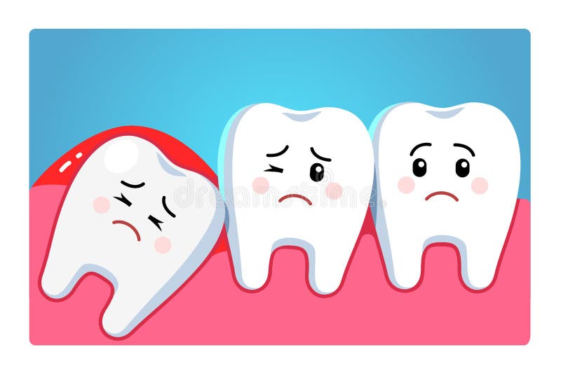 Wisdom Tooth Character, Third Molar Tooth Problem Stock Vector ...
