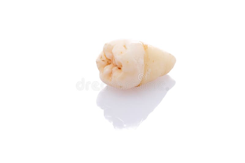 Wisdom Tooth Close-up White Isolated Stock Photo - Image of extraction ...