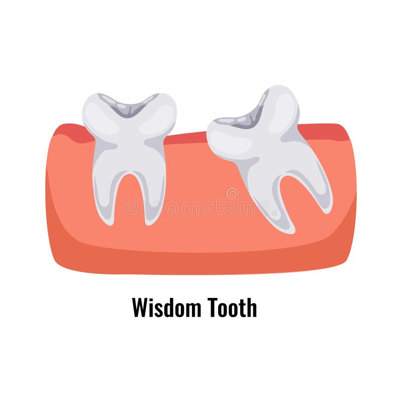 Wisdom Tooth Poster stock vector. Illustration of oral - 226692465