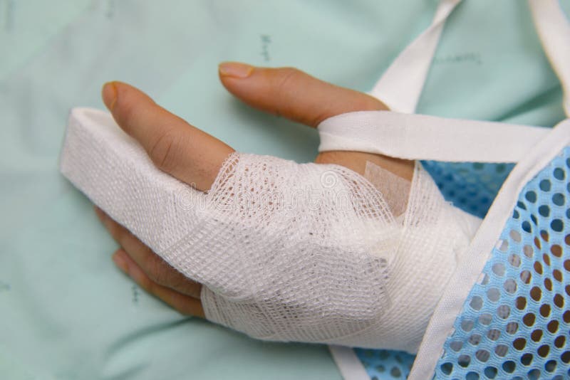 Wit Geneeskundeverband Op Gebroken Vinger Stock Foto - Image of ...