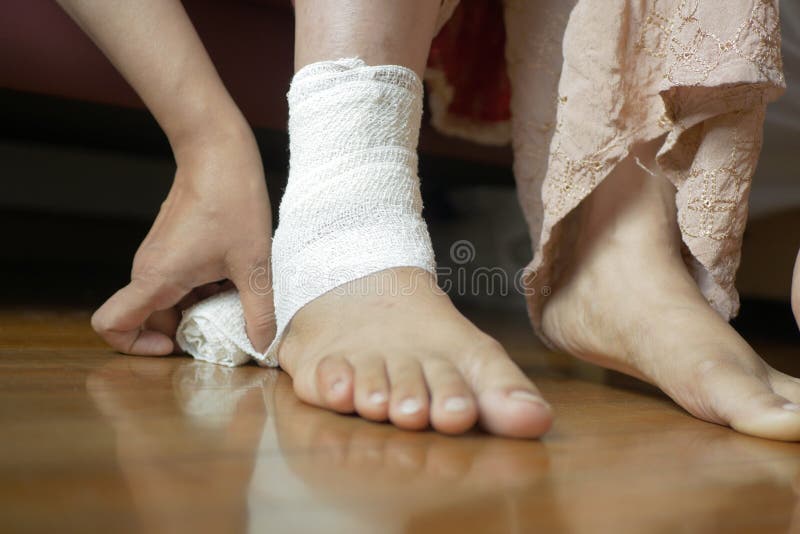 Woman with Bandaged Foot Close Up Stock Photo - Image of painful ...