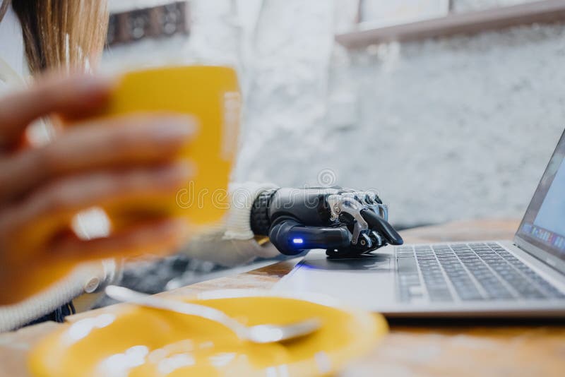 Woman with Bionic Hands is Working on a Laptop and Drinking Coffee in a ...