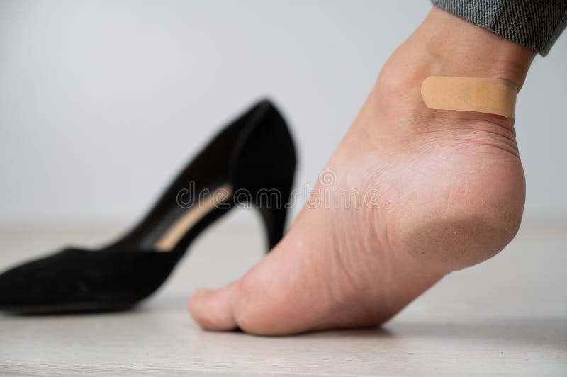 A Woman in Black Shoes Puts a Plaster on a Corn Stock Image - Image of ...