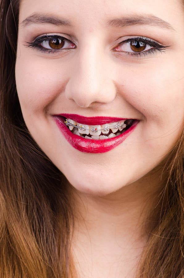The Woman with Brackets Isolated on White Stock Image - Image of face ...