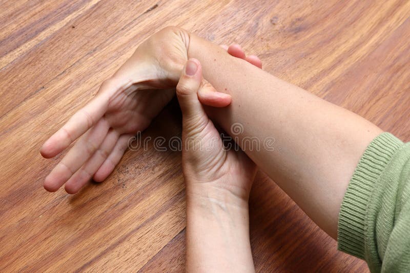 A Woman Demonstrating Joint Hyper Mobility in Her Hands. Stock Photo ...