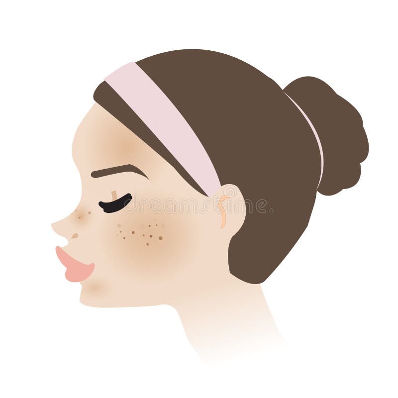 Melasma Skin Problem Stock Illustrations – 69 Melasma Skin Problem ...